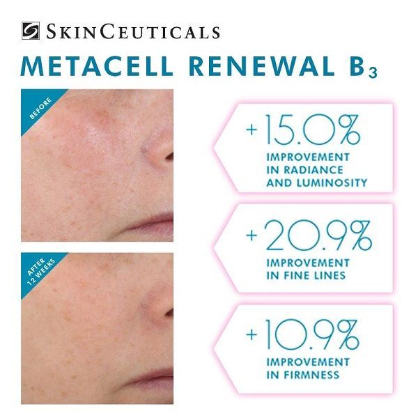 SkinCeuticals Metacell Renewal B3 | Free UK Delivery & Sample ...